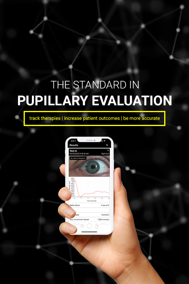 Reflex App - PLR Analyzer