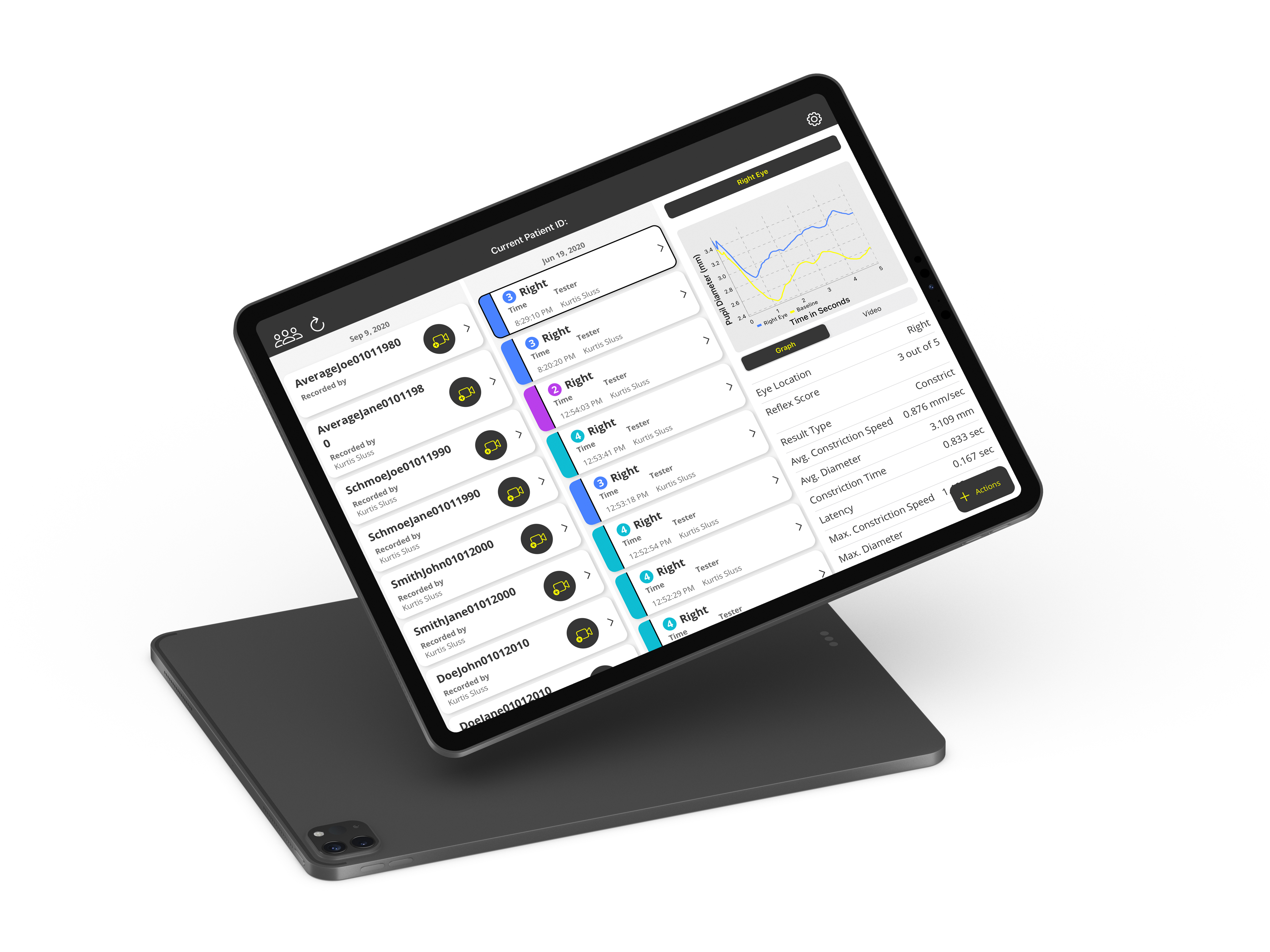 Reflex App - PLR Analyzer